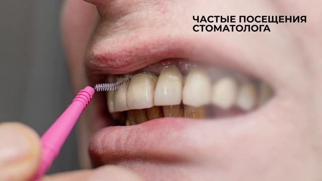 Показания к применению - зубная щетка redox с электрическими витаминами средней жесткости