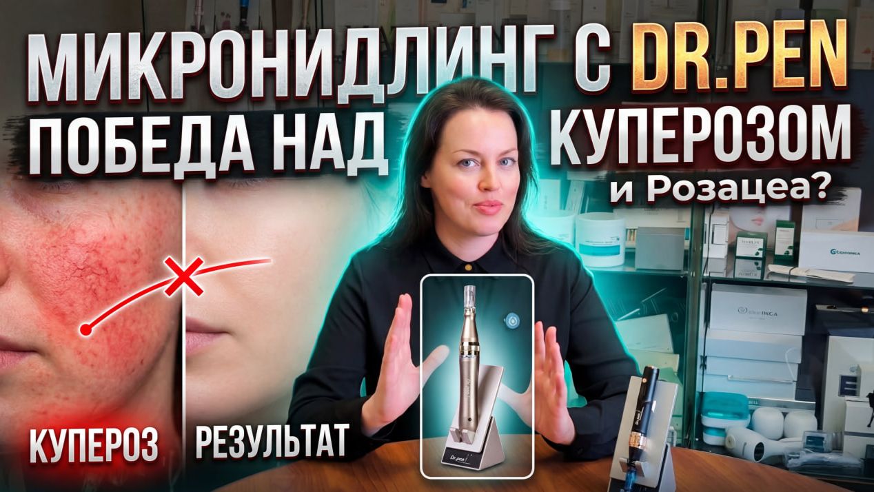 Дермапен НЕЛЬЗЯ при куперозе и розацеа | Правда или миф?