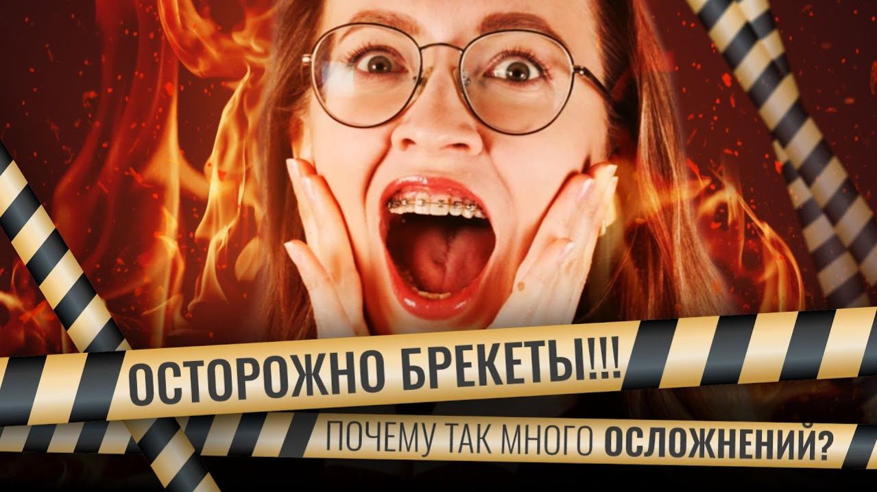 ОСТОРОЖНО, БРЕКЕТЫ!!! Почему так много осложнений?