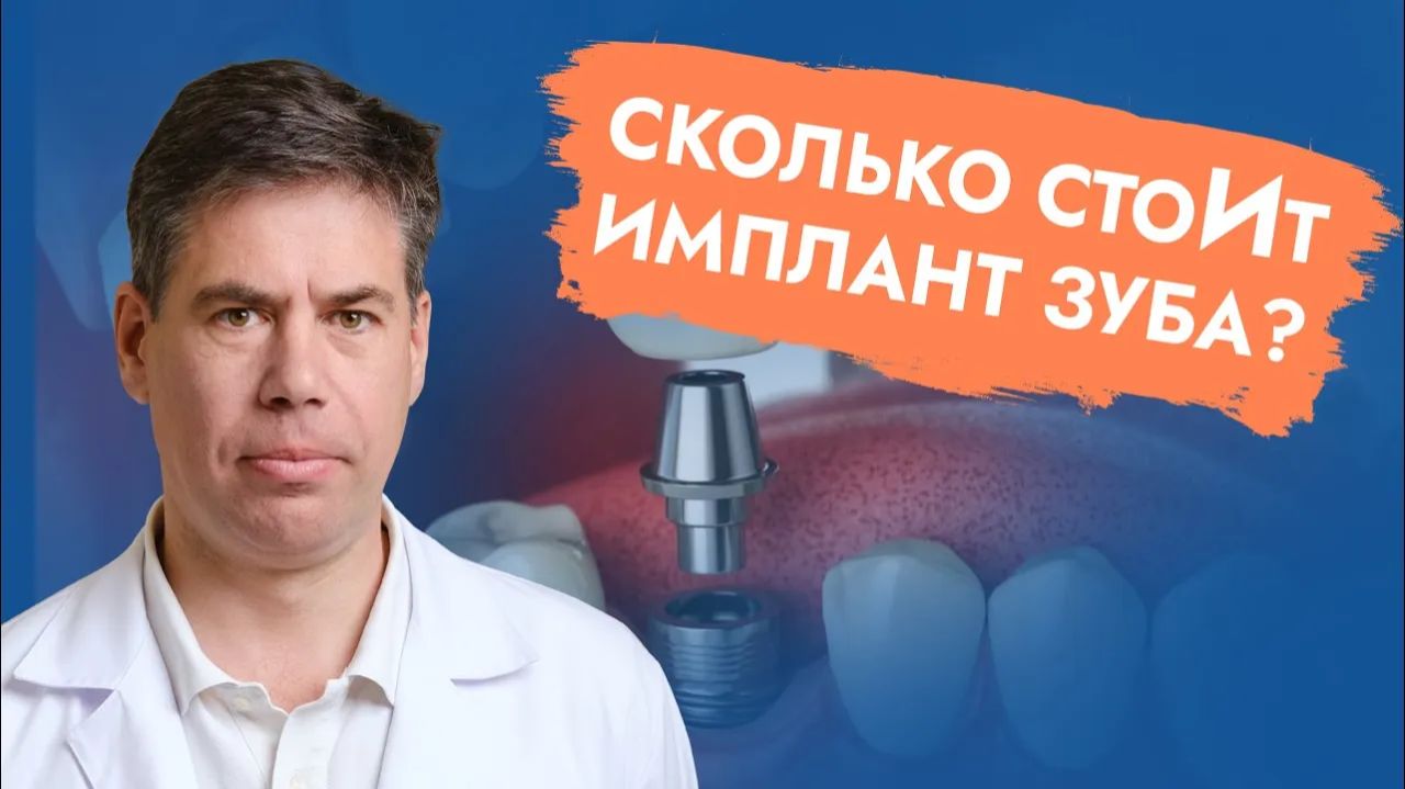 Сколько лет прослужит имплантат?