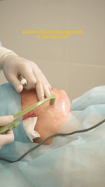 Отзыв пациента о процедуре Фейс Тайт