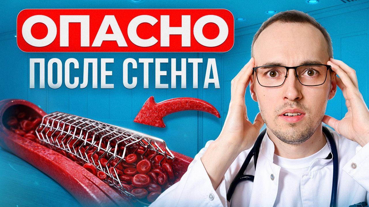 После СТЕНТИРОВАНИЯ нельзя делать ЭТО: 5 ОШИБОК, ОПАСНЫХ для сердца