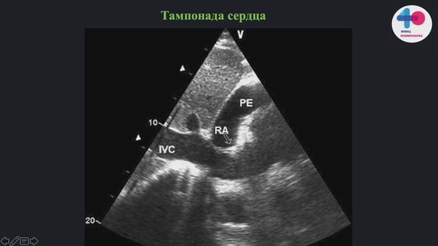 eFAST протокол Щепарев И.С.