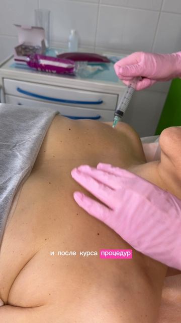 Пилинг PRX-T33