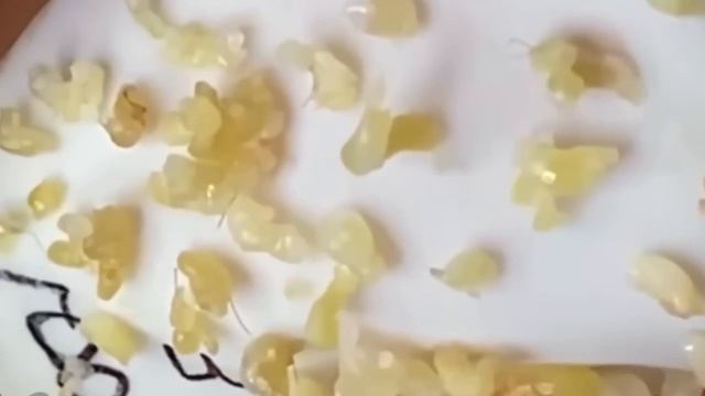 #198 Чистка лица от угрей и акне. Выдавливание прыщей. Удаление черных точек и комедонов