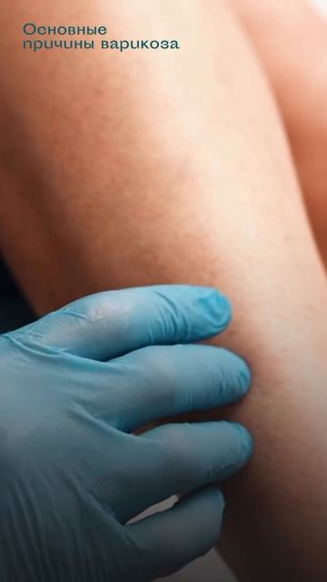 Основные причины варикоза, разбираем с врачом-флебологом