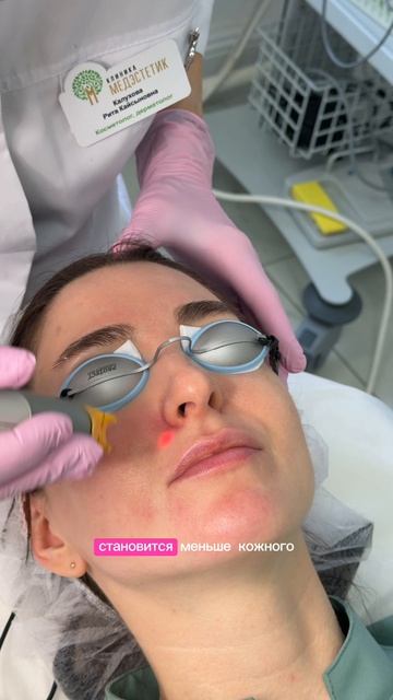 Бесконтактное омоложение Laser Genesis от XEO Cutera