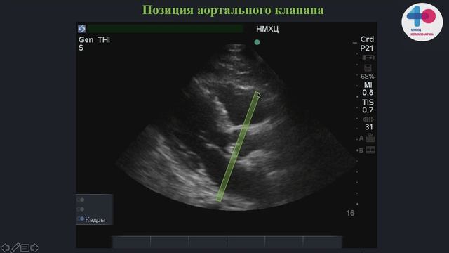 HOW TO волемич статус легочная артерия