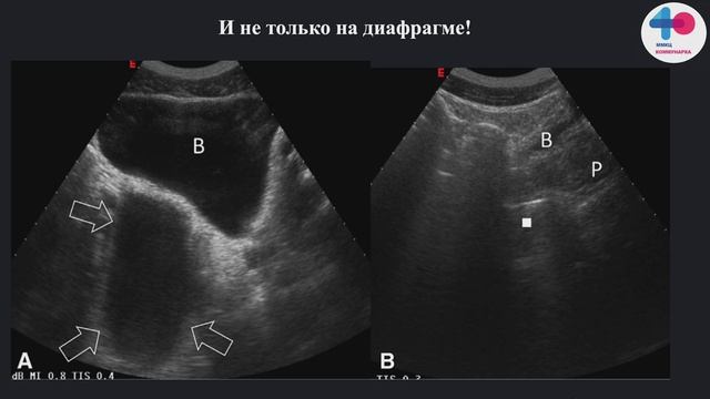 Ошибки eFAST Щепарев И.С.