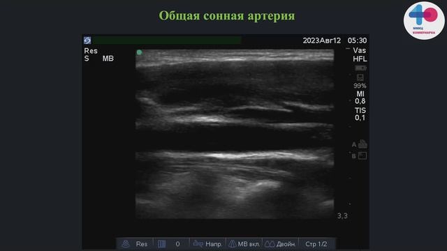 HOW TO  волемич статус яремная вена и сонная арт Щепарев И.С.