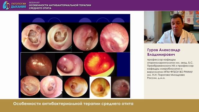 23.03.2026 Вебинар «Особенности антибактериальной терапии среднего отита»