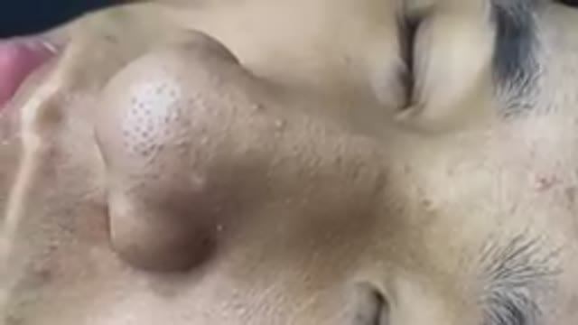 040 • Relax Spa • АСМР • Acne collection