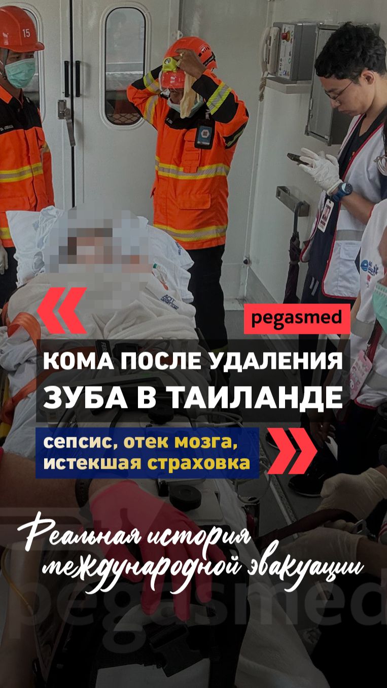 Смертельный зуб мудрости: как отдых в Таиланде обернулся комой для Екатерины Пановой