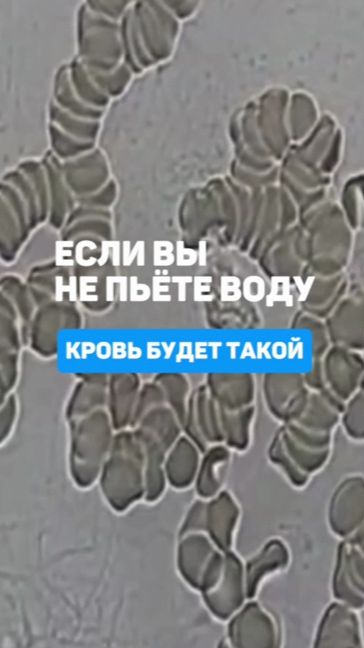 Если вы не пьете воду кровь будет такой. Семейный доктор Алена Братишко