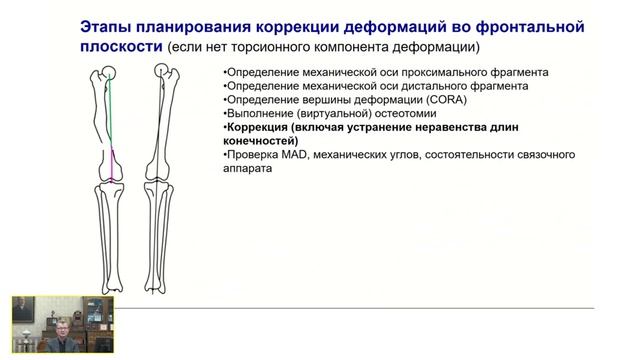 Принципы коррекции деформаций длинных костей.