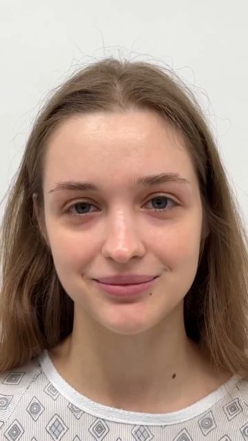 Консилер помогал? Замазать можно, но всё-равно видно...