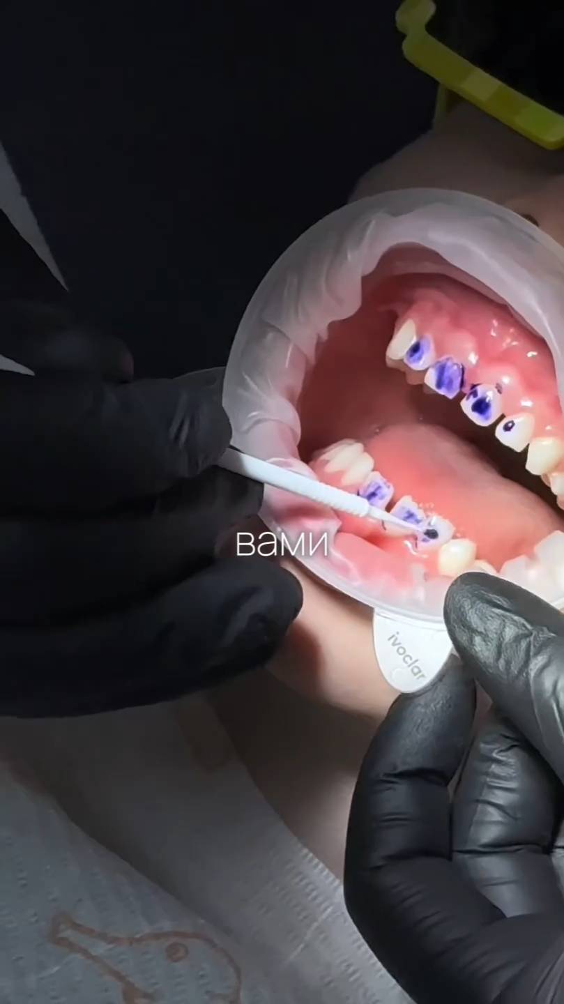 Ребёнка напугали у стоматолога 🫣