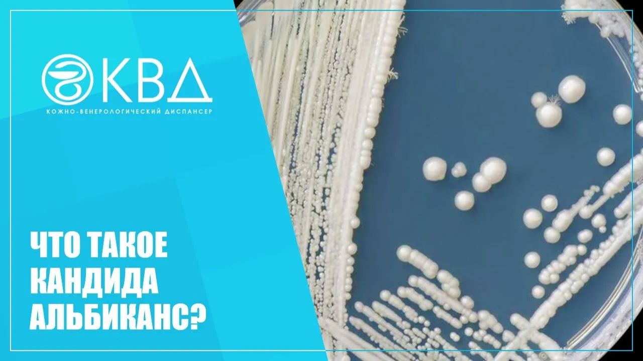 ✅ 1491  Что такое Кандида альбиканс