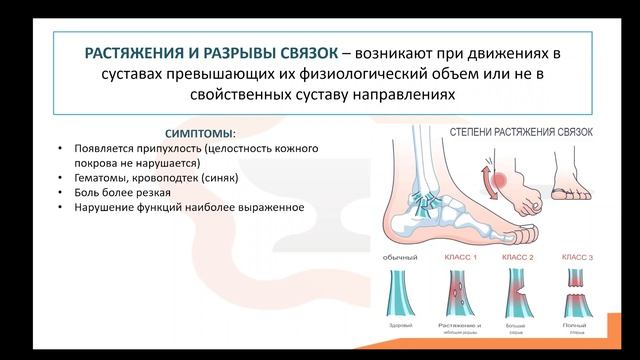 Лекция 13.2 Ушибы. Вывихи. Растяжения