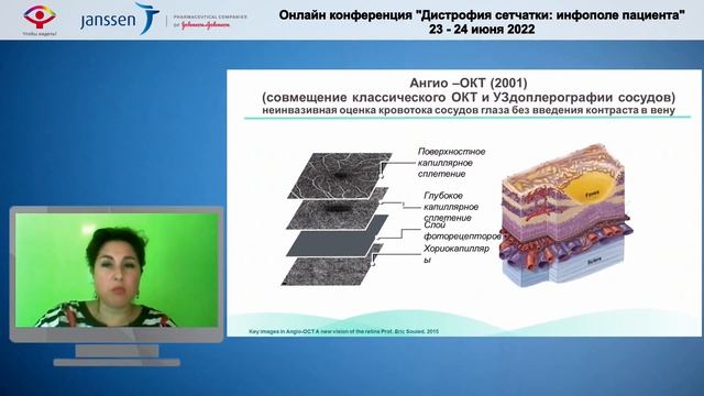 Архипова М.М. - Неоваскулярная возрастная макулярная дегенерация.  Как сохранить зрение?