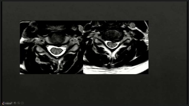 Интересные КТ и МРТ случаи в практике отделения лучевой диагностики городской больницы