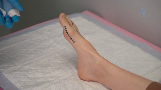 Перевязка ран в домашних условиях запомните эти правила