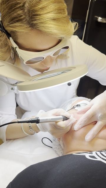 Желтый лазер для лечения сосудов QuadroStar Pro yellow