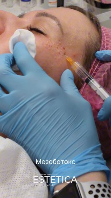 Мезоботокс