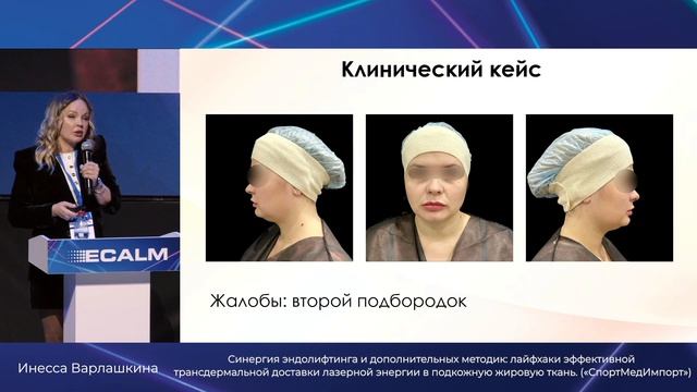Конгресс Ecalm 03.26, выступление спикера Инессы Варлашкиной