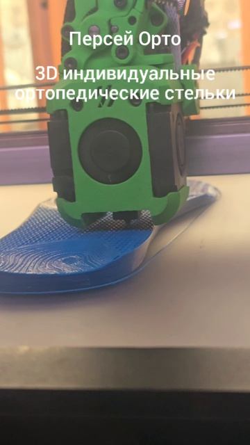 3D печать индивидуальных ортопедических стелек