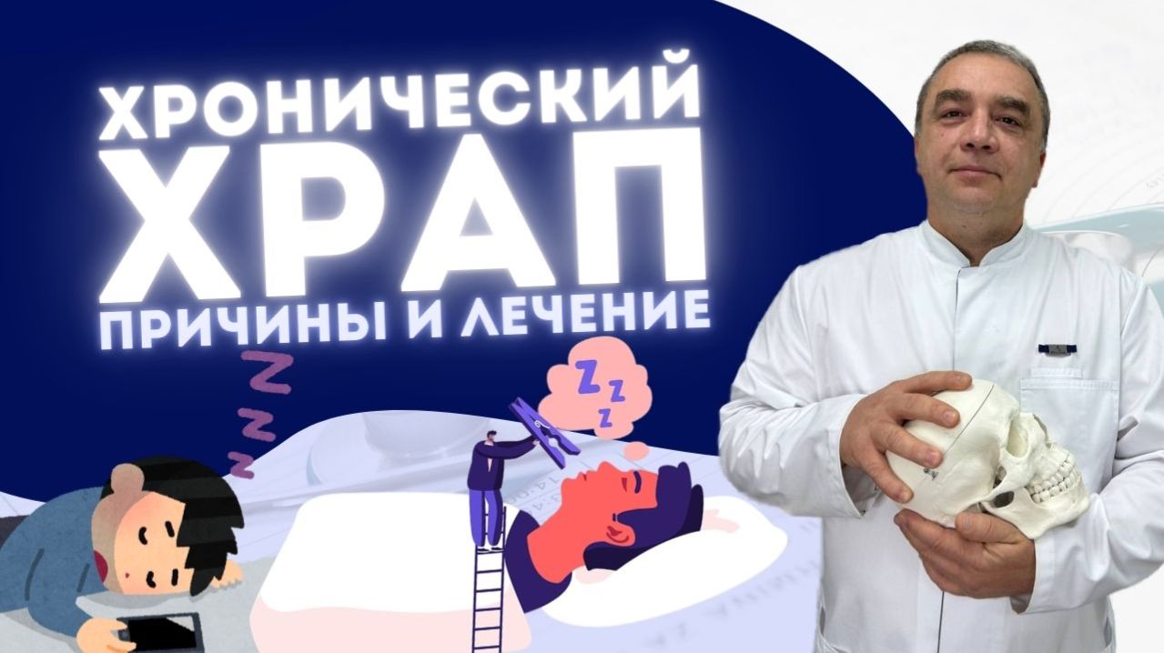 ХРОНИЧЕСКИЙ ХРАП: причины и простое лечение