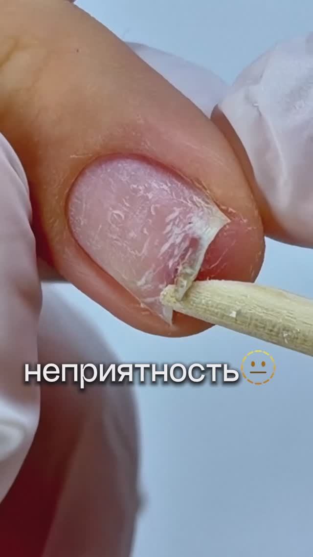 Сломала ноготь на баскетболе 🏀  Сделала ремонт верхними формами