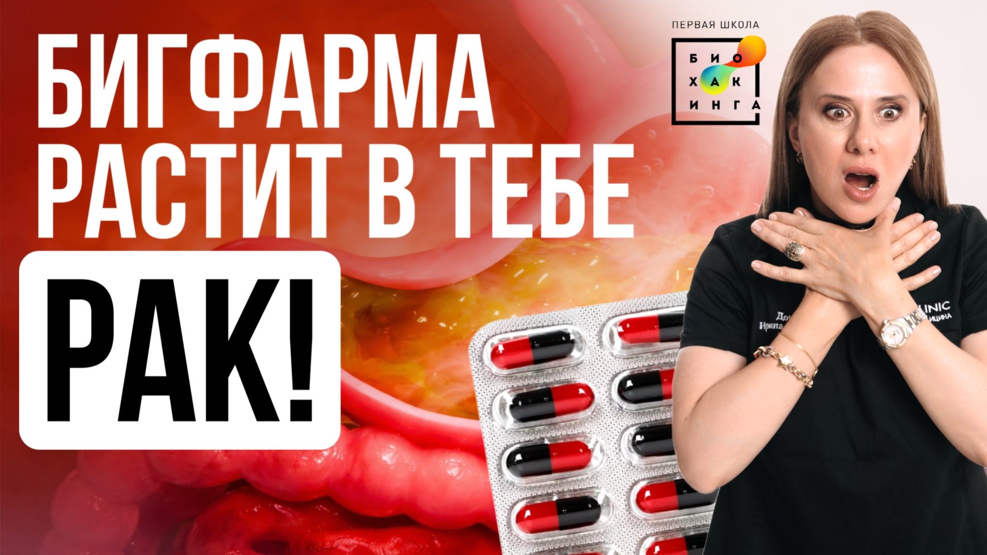 Реальная причина изжоги, отрыжки и даже РАКА желудка! Как нас травят врачи? #пшб #иринабаранова