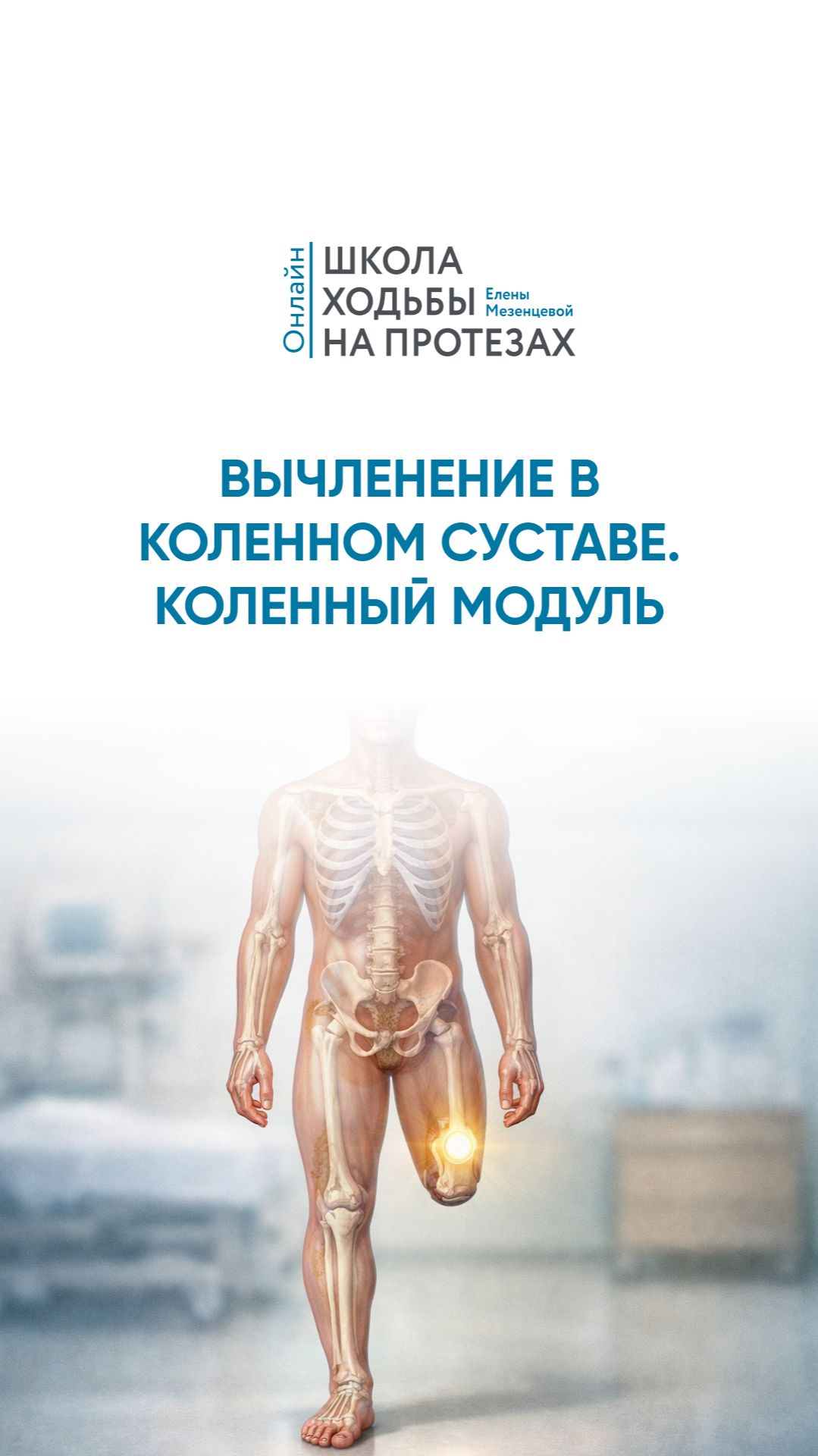 Вычленение в коленном суставе. Коленный модуль