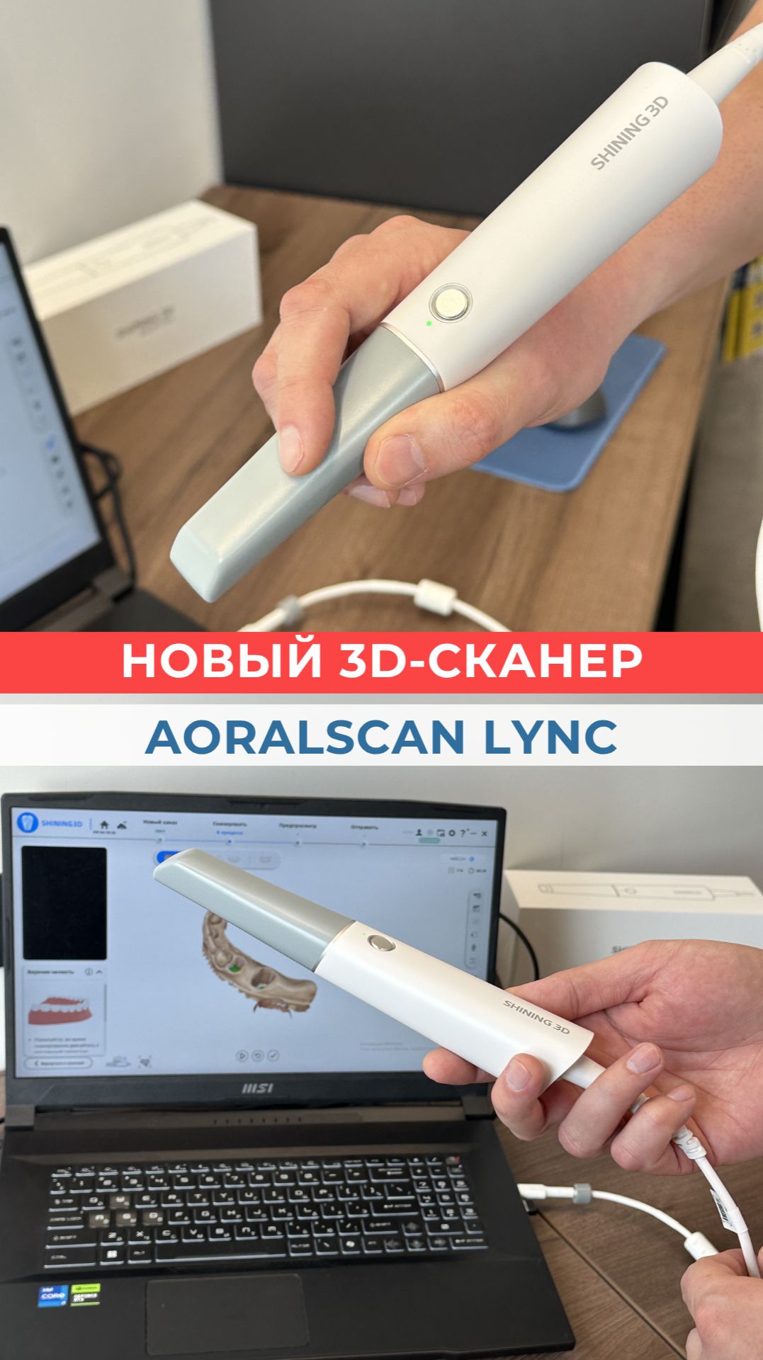 Новинка! Интраоральный 3D-сканер Aoralscan Lync от Shining 3D