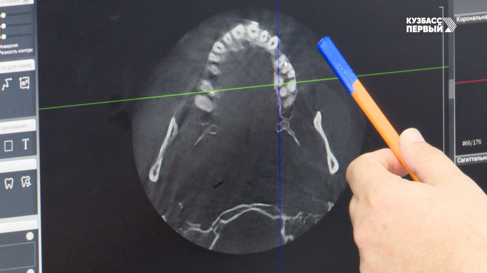 Здоровая улыбка России. Как влияет состояние полости рта на общее состояние здоровья?