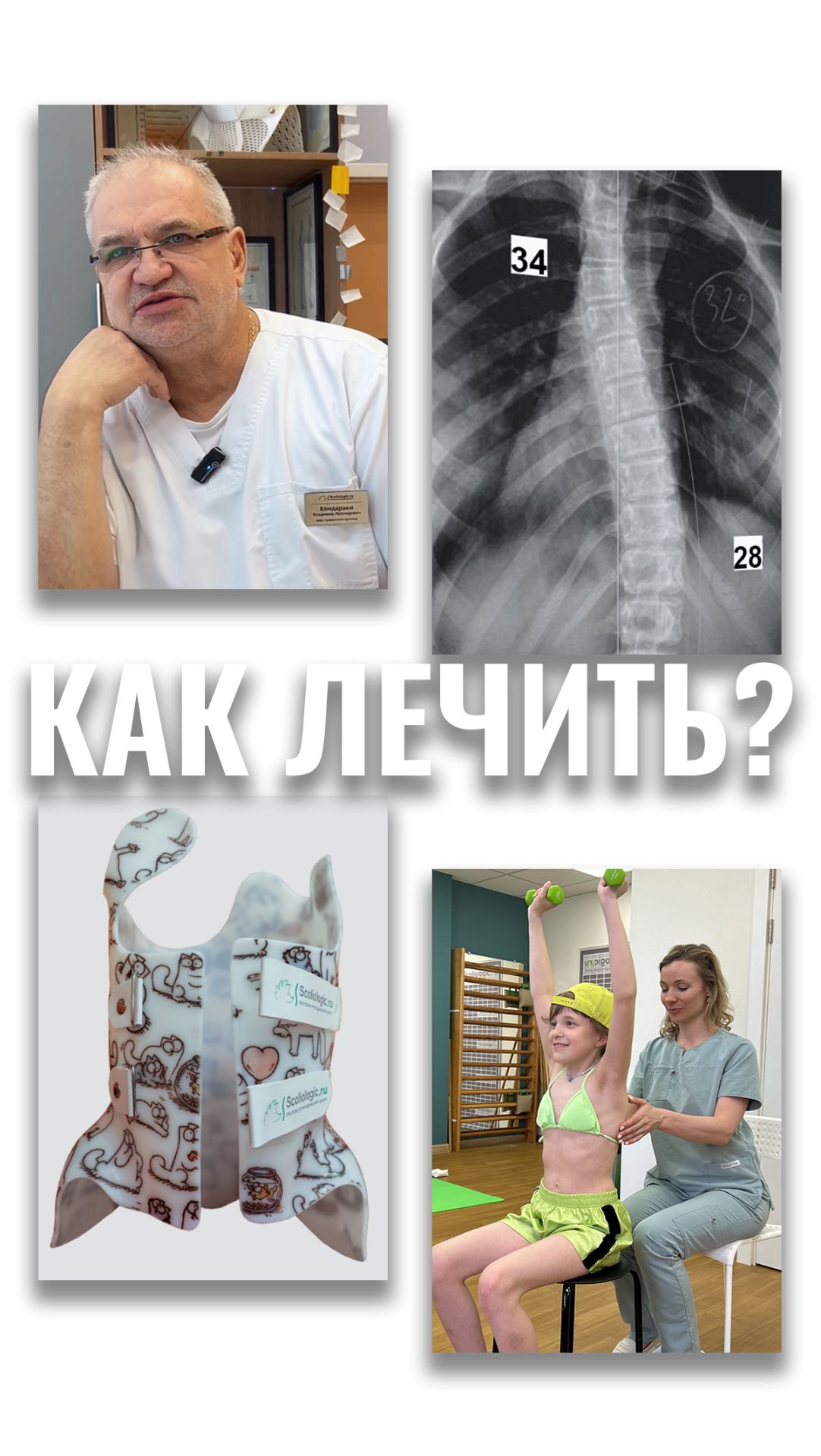 Верхнегрудная дуга – проблема?