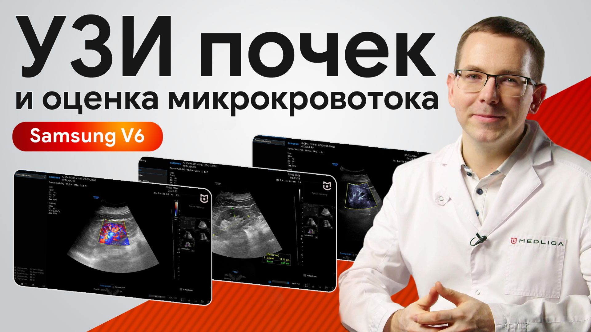 УЗИ почек на Samsung V6: измерения и оценка микрокровотока в реальной практике