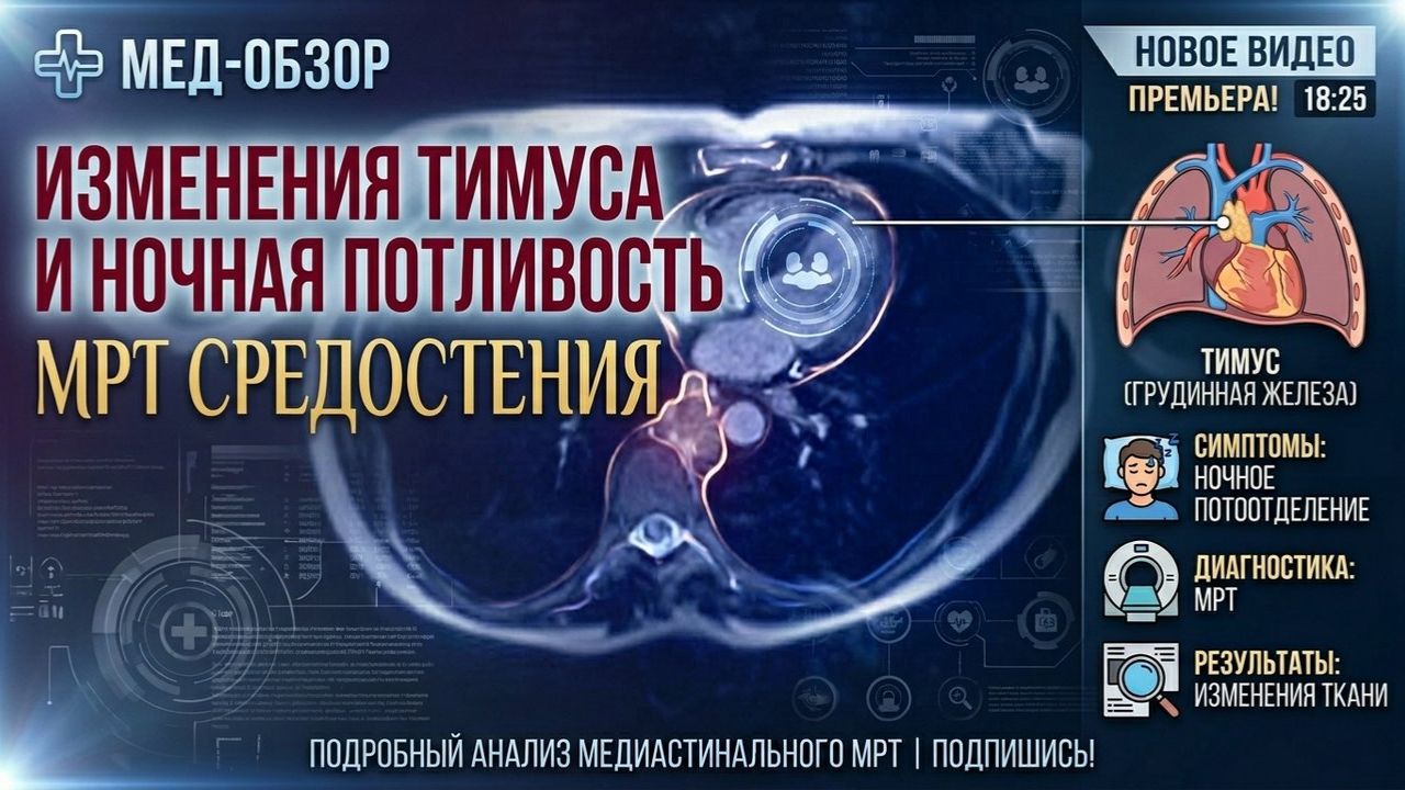 Ночное потоотделение (НОЧНАЯ ПОТЛИВОСТЬ у женщин) и изменения ТИМУСА на РАСШИФРОВКЕ МРТ средостения