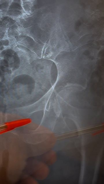 О ЧЕМ ГОВОРЯТ СЛЕЗЫ?