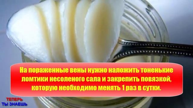 Забытая “МАЗЬ От ВАРИКОЗА! Через Месяц Ножки ЧИСТЫЕ, Вздутые Вены Спрятались