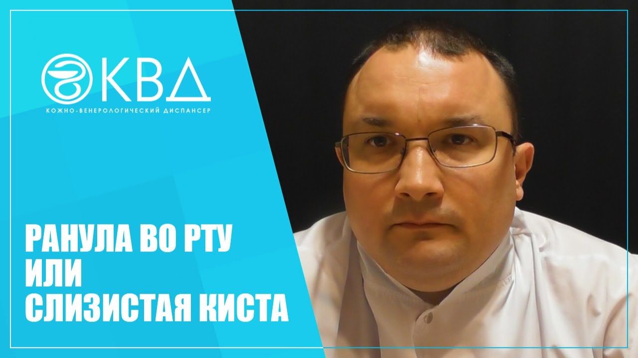 1300  Ранула во рту или слизистая киста