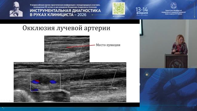 Ультразвуковая диагностика осложнений в зоне доступа при эндоваскулярных вмешательствах
