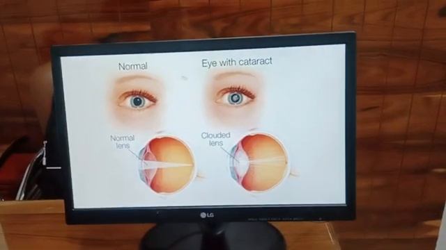 цифровая таблица остроты зрения