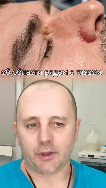 Родинка рядом с глазом: до и после