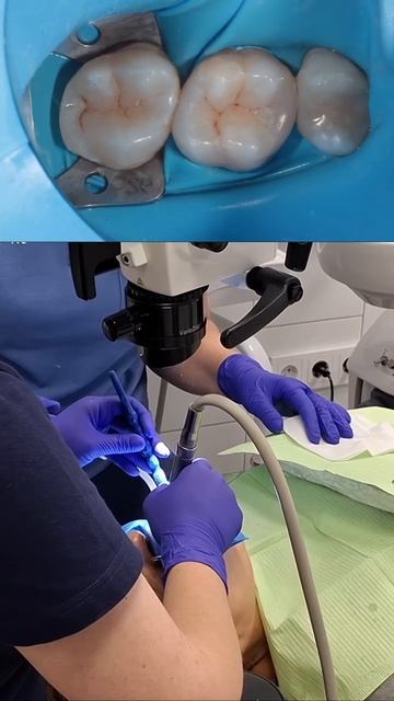 Реставрация жевательных зубов