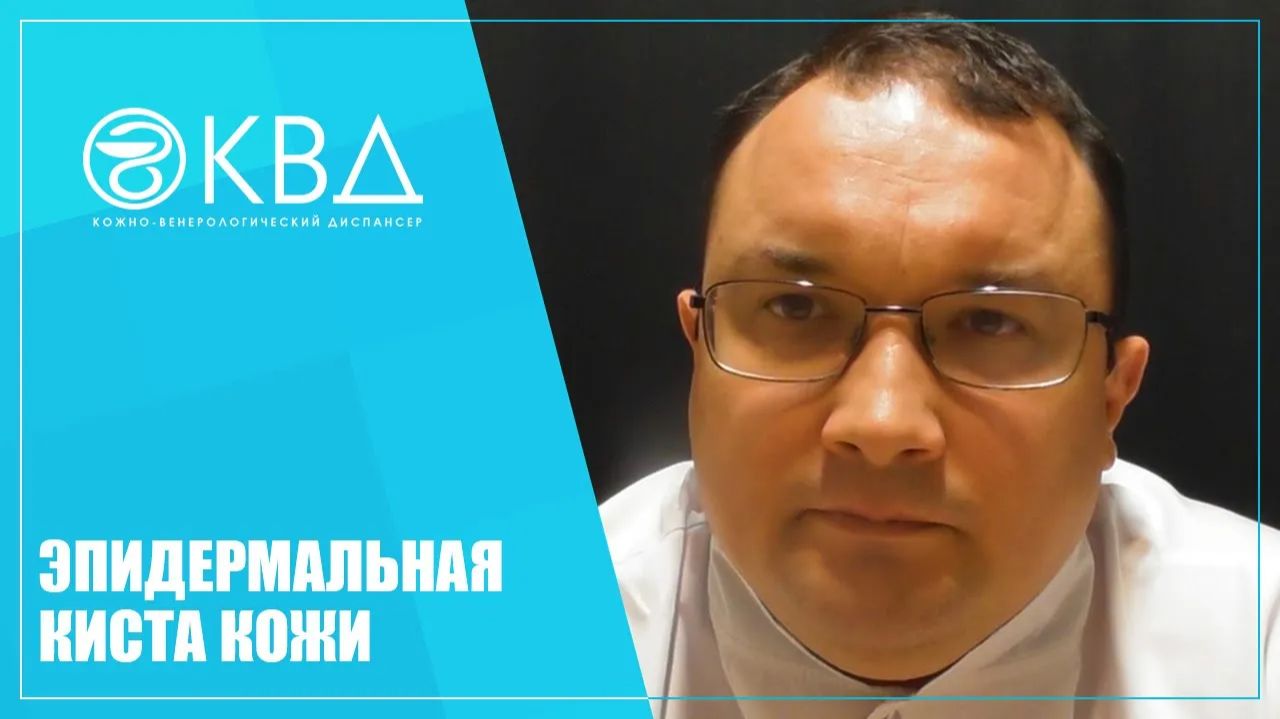 1340  Эпидермальная киста кожи