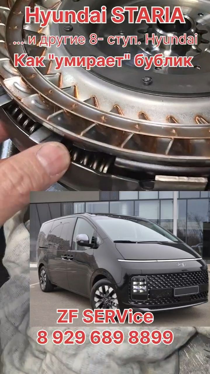 Hyundai STARIA ... и другие 8 - ступ акпп Hyundai. Как " умирает" бублик....