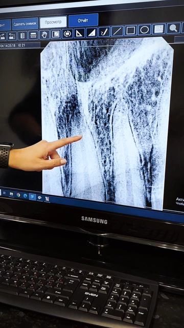 Снятие острой зубной боли: как это происходит