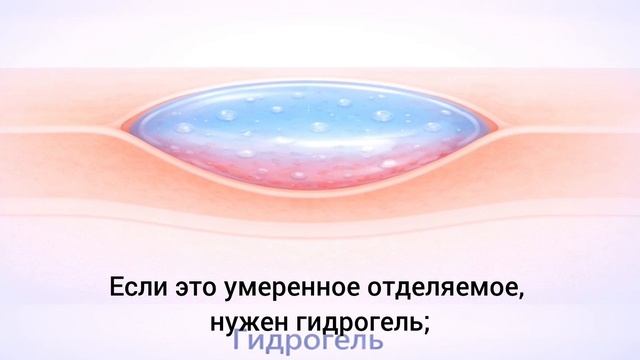 6. Лечение пролежней 2 степени